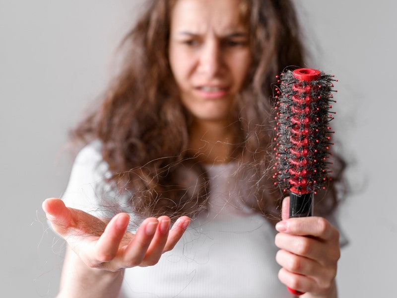 Do you lose your hair a lot? Know its causes, prevention and how to ca – Pronapresa